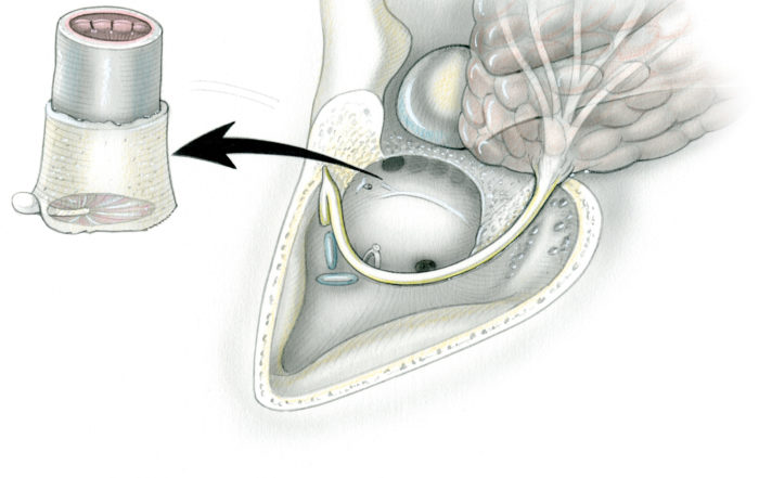 Standard Procedure – Skull Base Surgery Atlas