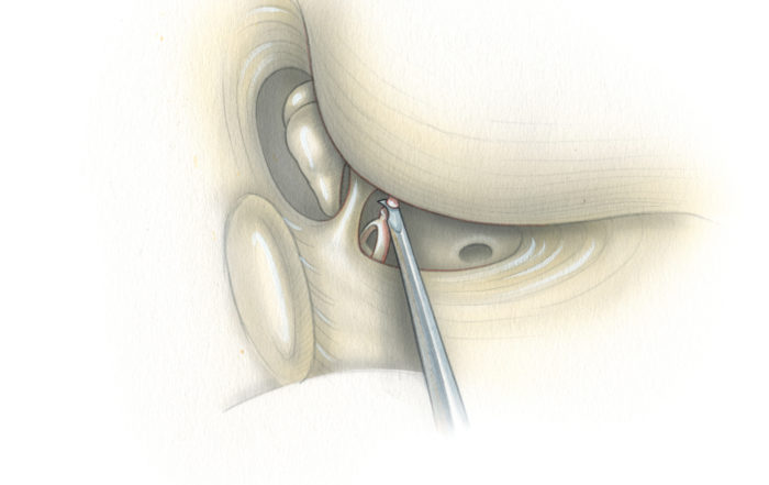 Standard Procedure – Skull Base Surgery Atlas